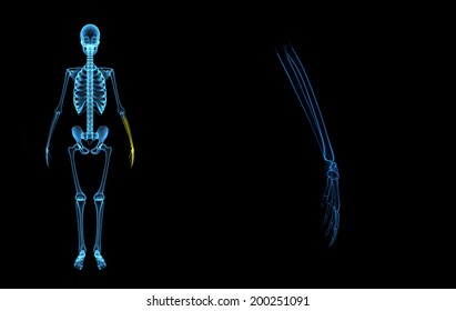 Human Upper Limb Bones Distal Anatomy Stock Illustration 2127249140