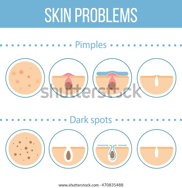 Skin Problems Icons Set Stock Illustration 470835488