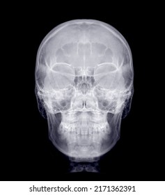 Skull Xray Image Human Front View Stock Illustration 2171362391 ...