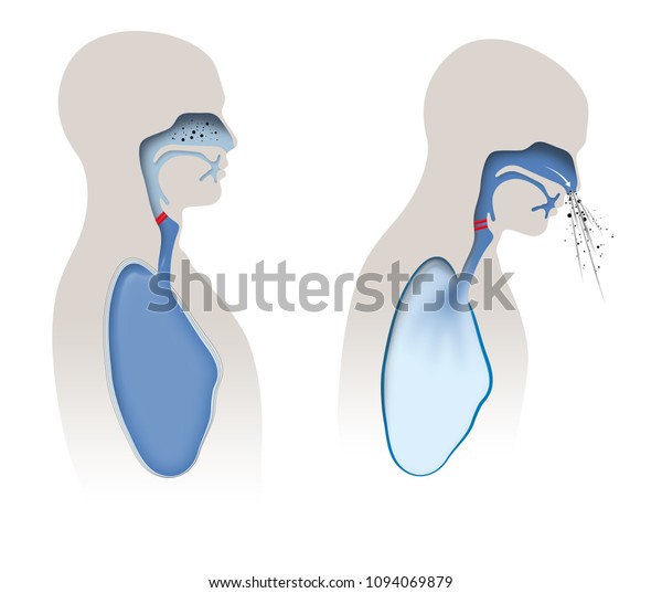 Source Mechanism Cough Sneeze 스톡 일러스트 1094069879