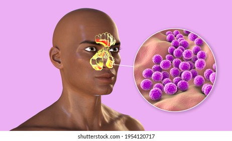 1,027 imágenes de Senos frontales anatomía - Imágenes, fotos y vectores ...