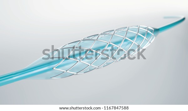 Stent Closeup 3d Rendering 스톡 일러스트 1167847588