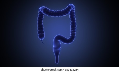 651件の「Sigmoid colon cancer」の画像、写真素材、ベクター画像 | Shutterstock