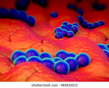 Superbug Staphylococcus Aureus Mrsa Bacteria 3d 스톡 일러스트 483409732 ...