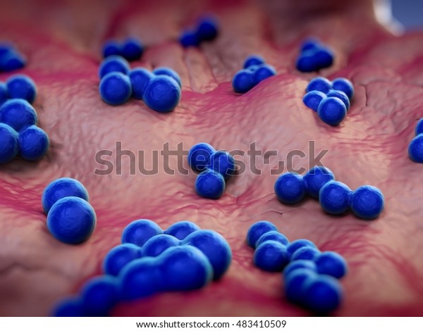 Superbug Staphylococcus Aureus Mrsa Bacteria 3d 스톡 일러스트 483410509 ...