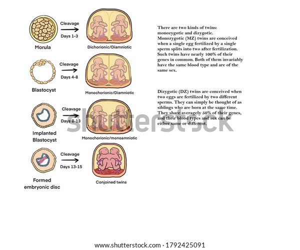 There Two Types Twins Identical Monozygotic Stok İllüstrasyon 1792425091