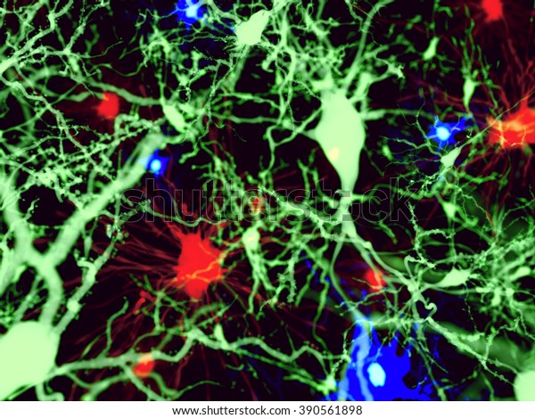 Three Types Brain Cells Red Astrocytes Stock Illustration 390561898