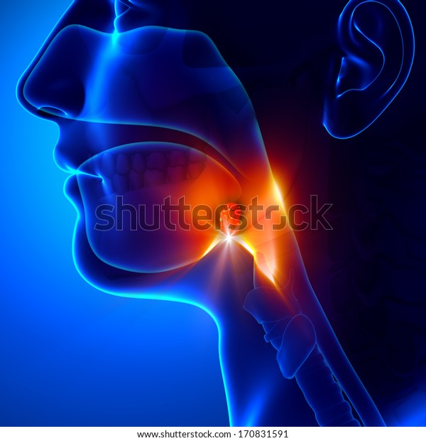 Tonsils Angina Pectoris Stock Illustration 170831591