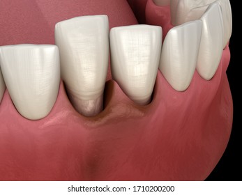 Tooth Dislocation After Trauma Medically Accurate Stock Illustration ...