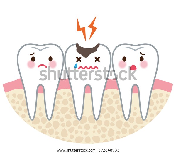 Tooth Men Tooth Decay Section View Stock Illustration 392848933 ...
