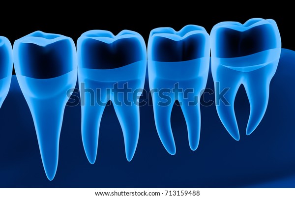 Transparent Teeth Scan Xray View 3d Stock Illustration 713159488 ...