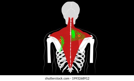 Trigger Points Reflected Pain Trapezius Anatomy Stock Illustration ...