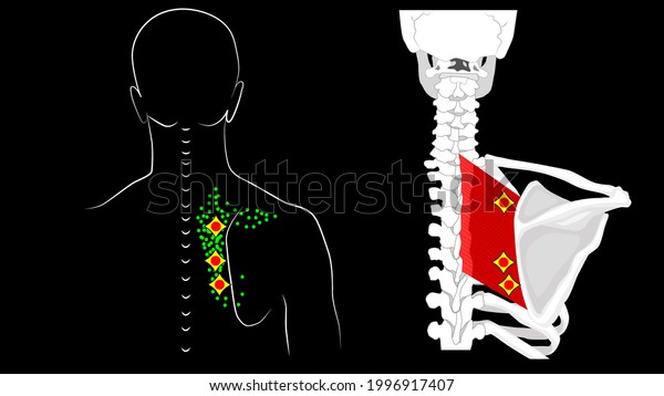Trigger Points Rhomboid Major Rhomboid Minor Stock Illustration ...