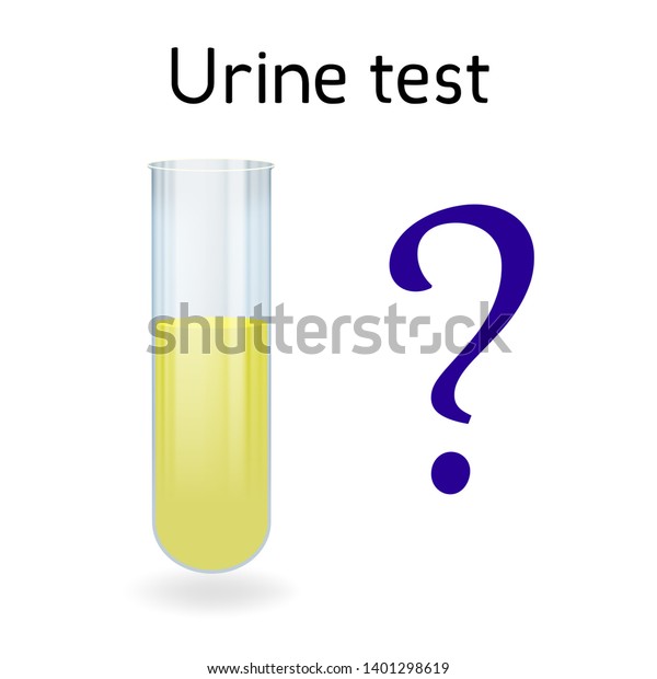 Tube Urinary Sample Test Analysis Question Stock Illustration ...