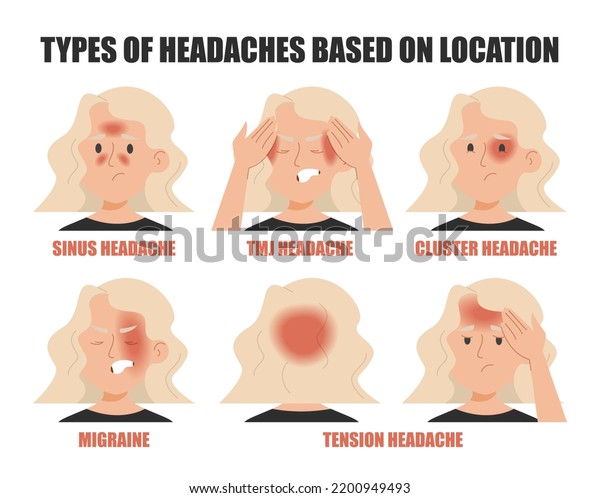 Types Headache Based On Location Pain 库存插图 2200949493 | Shutterstock