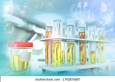 62 Urinary Cast Images, Stock Photos & Vectors | Shutterstock