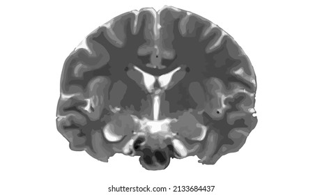 Vectorised Mri Brain Image On White Stock Illustration 2133684437