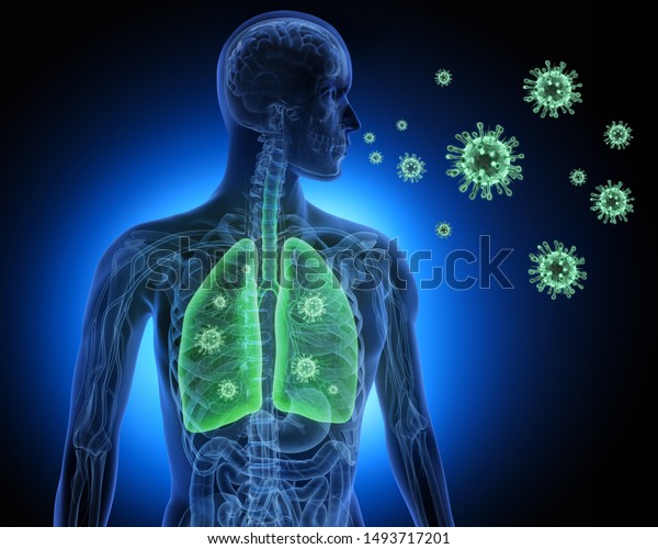 Visual Concept Viral Immune System Attack Arkivillustrasjon 1493717201