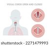2,469 Vocal Cords Images, Stock Photos, 3D objects, & Vectors ...
