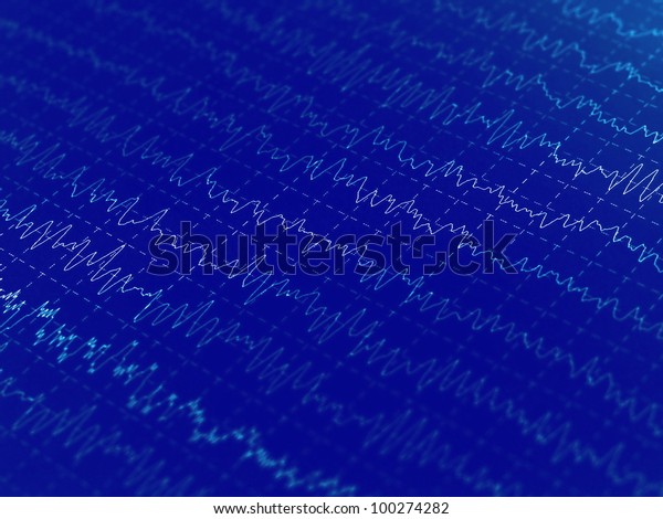 Wave Oscillations Brain Waves On Encephalogramme Stock Illustration ...