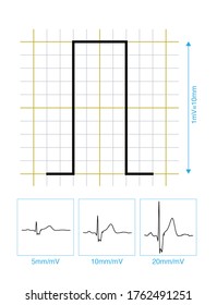 When 1mv Voltage Input Different Ecg Stock Illustration 1762491251 ...