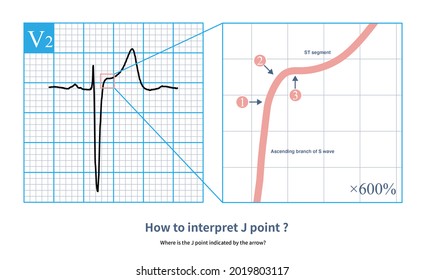 899 Qrs Wave Images, Stock Photos & Vectors | Shutterstock