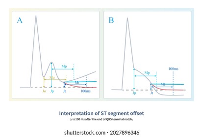 21 Notch t wave Images, Stock Photos & Vectors | Shutterstock
