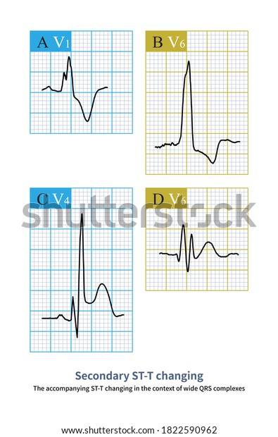 Wide qrs : 104 images, photos et images vectorielles de stock ...
