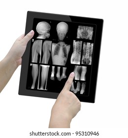3,616 Radiology Tablet Images, Stock Photos & Vectors | Shutterstock