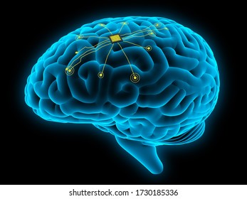 43 Xray Microchip Images, Stock Photos & Vectors | Shutterstock