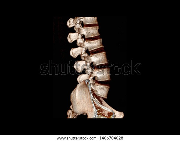 3d Computer Tomography Ct Scan Imaging Stock Photo 1406704028 ...