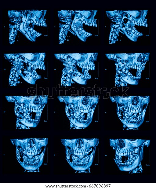 3d Ct Scan Three Computed Tomography Foto de stock 667096897 | Shutterstock