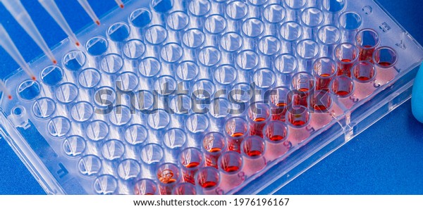 96 Well Plate Pcr Processing Microbiological Stock Photo 1976196167 ...