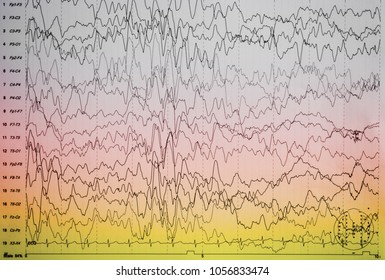 Abnormal Eeg Wave Formabnormal Eegbrain Wave库存照片1056833471 | Shutterstock