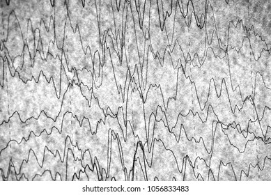 Abnormal Eeg Wave Formabnormal Eegbrain Wave Stock Photo 1056833483 ...
