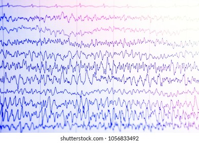 Abnormal Eeg Wave Formabnormal Eegbrain Wave 스톡 사진 1056833492 ...