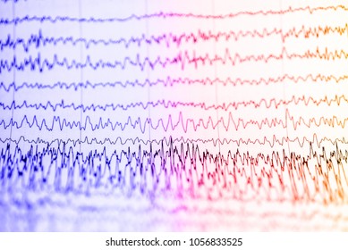 Abnormal Eeg Wave Formabnormal Eegbrain Wave Stock Photo 1056833525 ...
