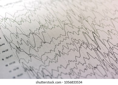 Abnormal Eeg Report Hospitaleeg Wave Background Stock Photo (Edit Now ...