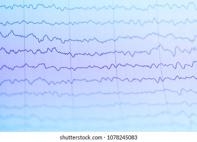 Abnormal Eeg Waveform Abnormal Eeg Brainwave Stock Photo 1078245083 ...