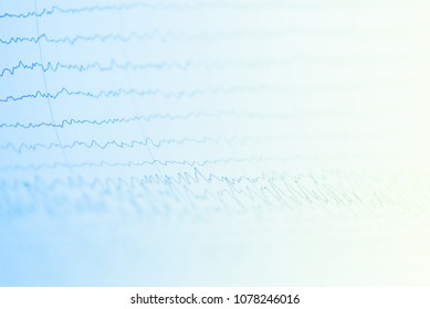 Abnormal Eeg Waveform Abnormal Eeg Brainwave Stock Photo (Edit Now ...