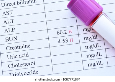 Abnormal Renal Function Test Results Blood库存照片1087771874 | Shutterstock