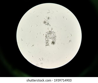 Abnormal Result Urinalysis Microscopic Method Under Foto Stok ...