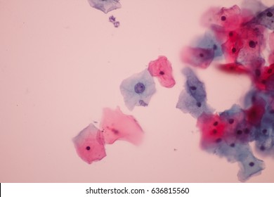 Normal Endocervical Cells Squamous Epithelial Cells Foto de stock ...