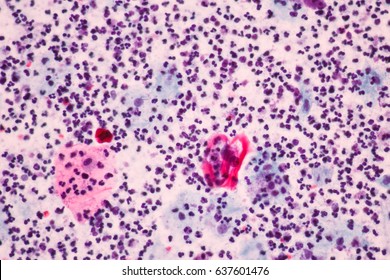 57 imágenes de Endocervix - Imágenes, fotos y vectores de stock ...