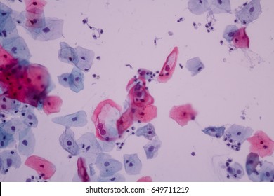 57 imágenes de Endocervix - Imágenes, fotos y vectores de stock ...
