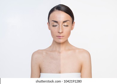 156,188 Spots on face Images, Stock Photos & Vectors | Shutterstock