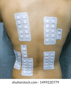 43 Test allergic back patch Images, Stock Photos & Vectors | Shutterstock