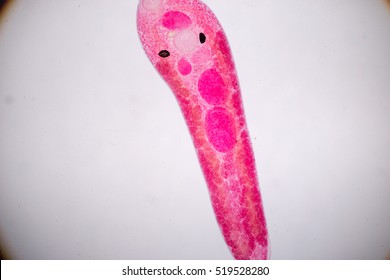 Paramphistomiasis Images, Stock Photos & Vectors | Shutterstock