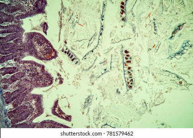 Amoebic Dysentery Under Microscope Stock Photo 781579462 | Shutterstock