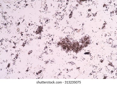Amorphous Urine Sample Fine Microscope Stock Photo 313235075 | Shutterstock
